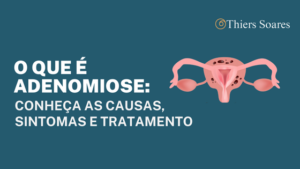 O QUE É ADENOMIOSE: conheça as causas, sintomas e tratamento – Dr. Thiers