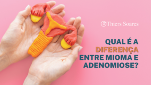 Qual é a diferença entre mioma e adenomiose? – Dr. Thiers