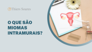 O que são os Miomas Intramurais? – Dr. Thiers